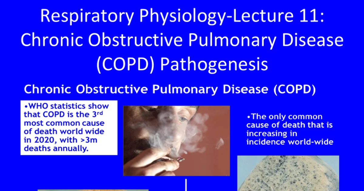 Respiratory Physiology COPD Pathogenesis | Algor Library